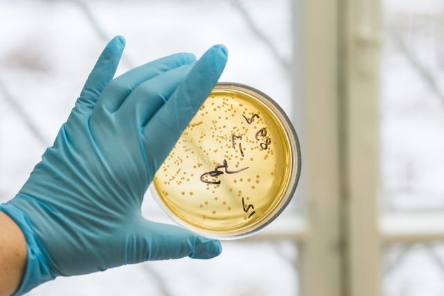 Acinetobacter: o que é, sintomas, como acontece a infecção e como ... Acinetobacter: o que é, sintomas, como acontece a infecção e como ...